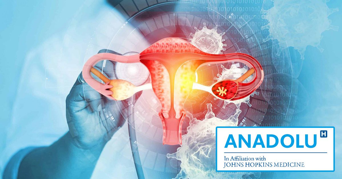 Cancer de l'ovaire : symptômes, causes et traitement au Centre Médical Anadolu - Algerie360