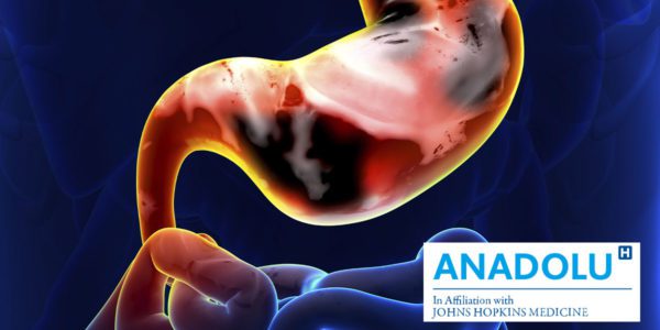 Le traitement des cancers gastro-intestinaux au Centre Médical Anadolu ...
