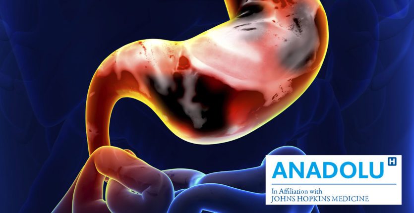 Le traitement des cancers gastro-intestinaux au Centre Médical Anadolu ...