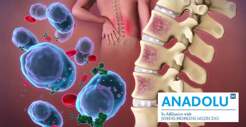 Myélome multiple (ou cancer de la moelle osseuse) : ce qu'il faut ...