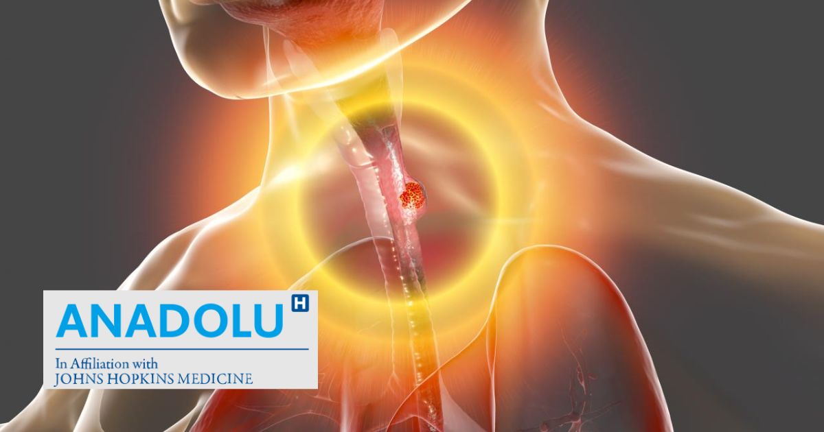 CANCER DE L'ŒSOPHAGE : Symptômes et Traitement (Centre Médical Anadolu)