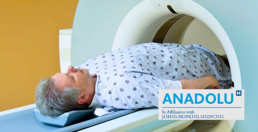 Gallium-68 PSMA : une avancée majeure dans le traitement du cancer de ...