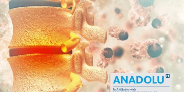 Tumeurs osseuses : Tout savoir sur cette maladie (symptômes et traitements)